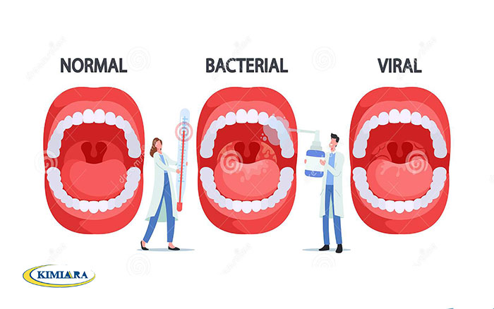عفونت باکتریایی گلو - Kimiara Pharmaceutical Company